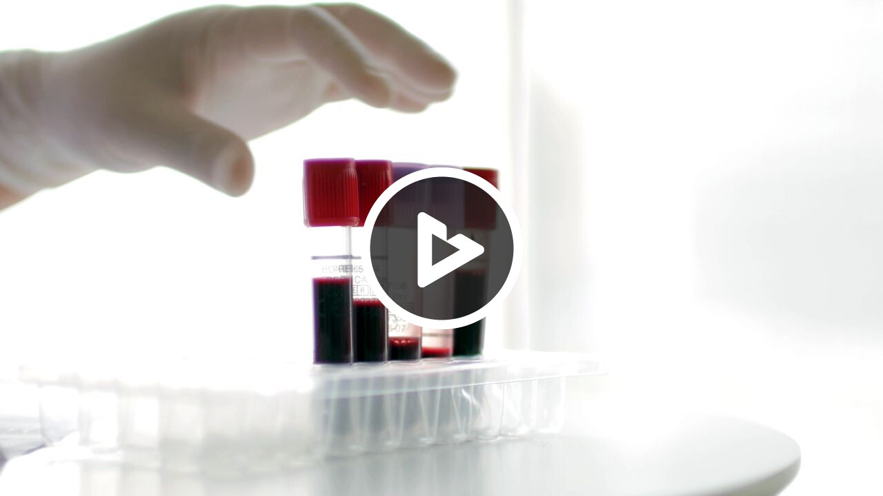 Allergy Blood Test