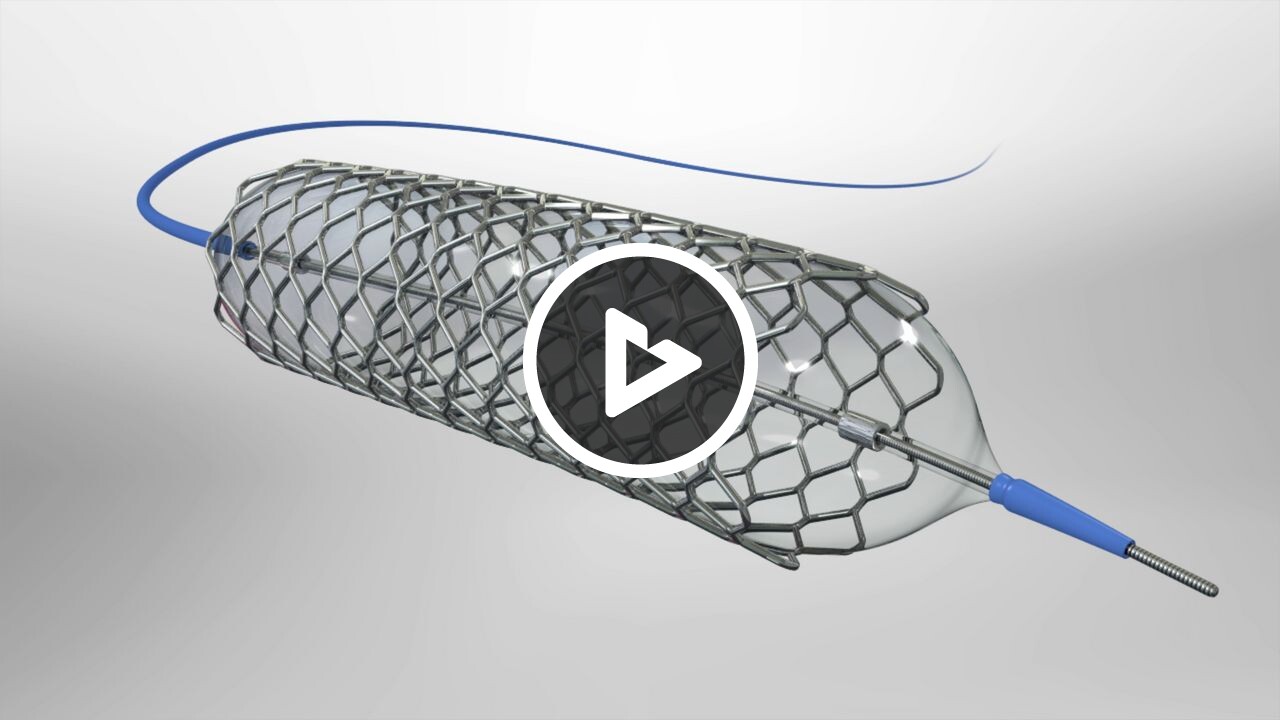 Cardiovascular Stent Placement