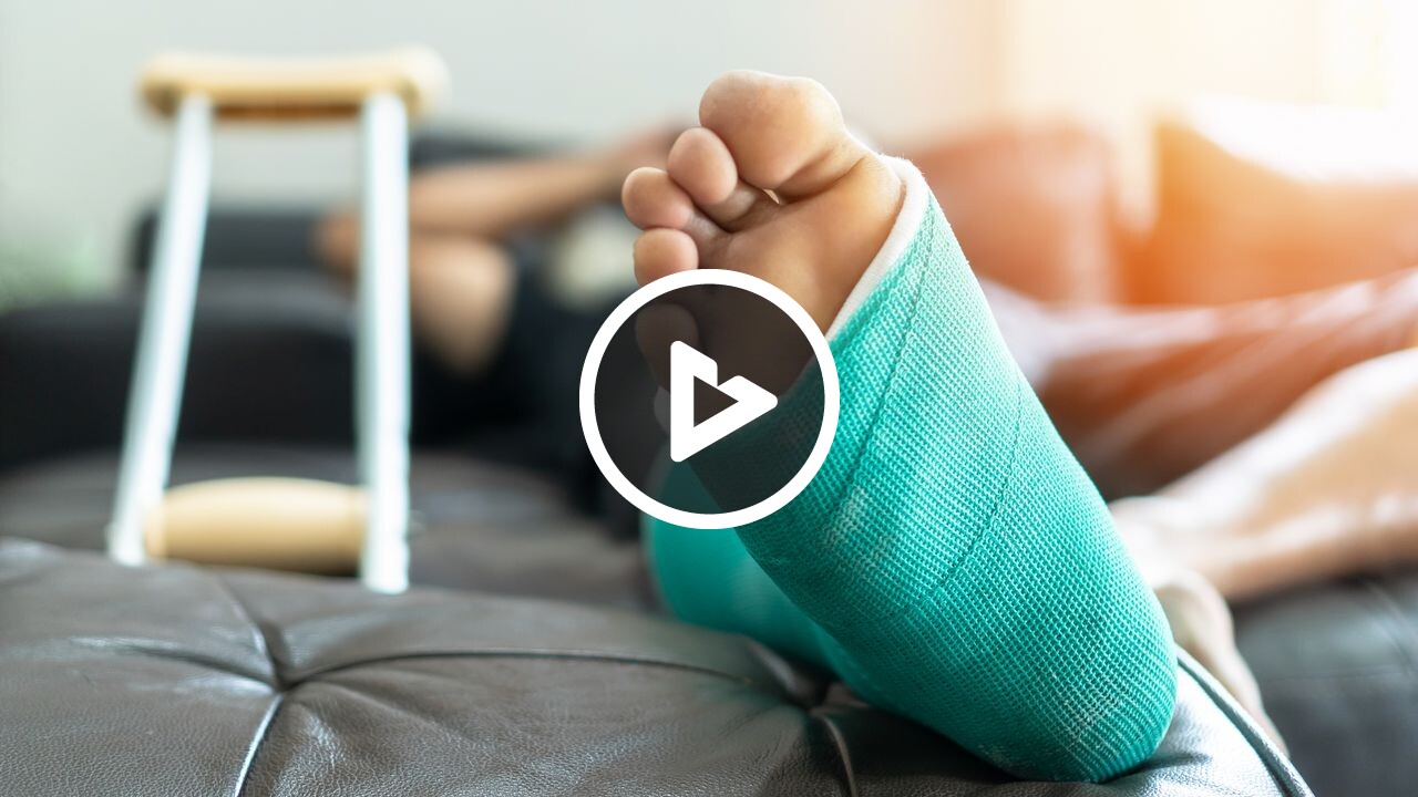 Caring for Your Cast