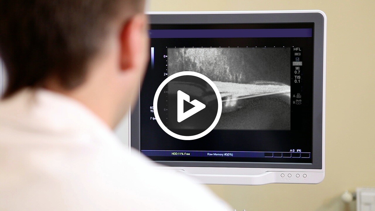 HYALGAN Injection for Knee Pain (Ultrasound Guided)