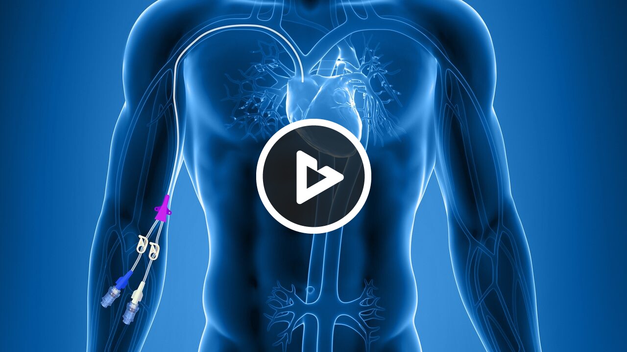 PICC Line (Peripherally-Inserted Central Catheter)