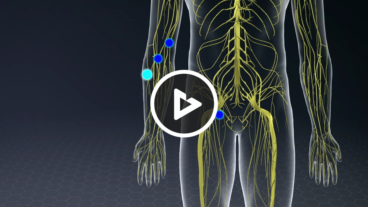Anesthesia (Peripheral Nerve Block)