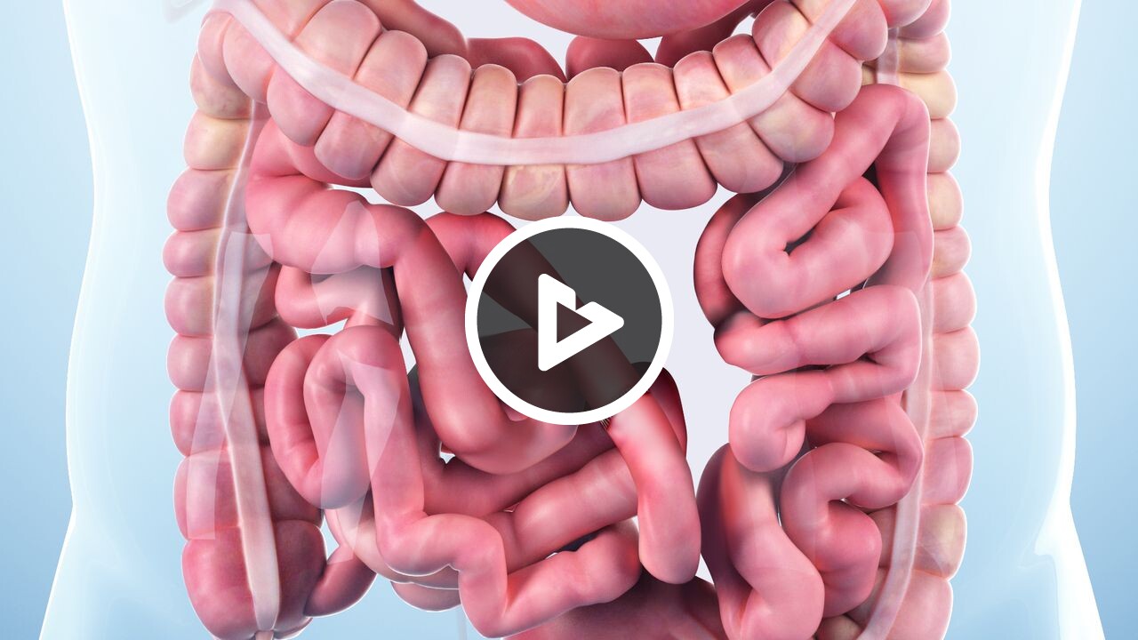Small Bowel Resection